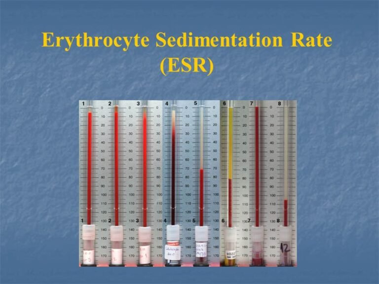Esr Westergren News And Info